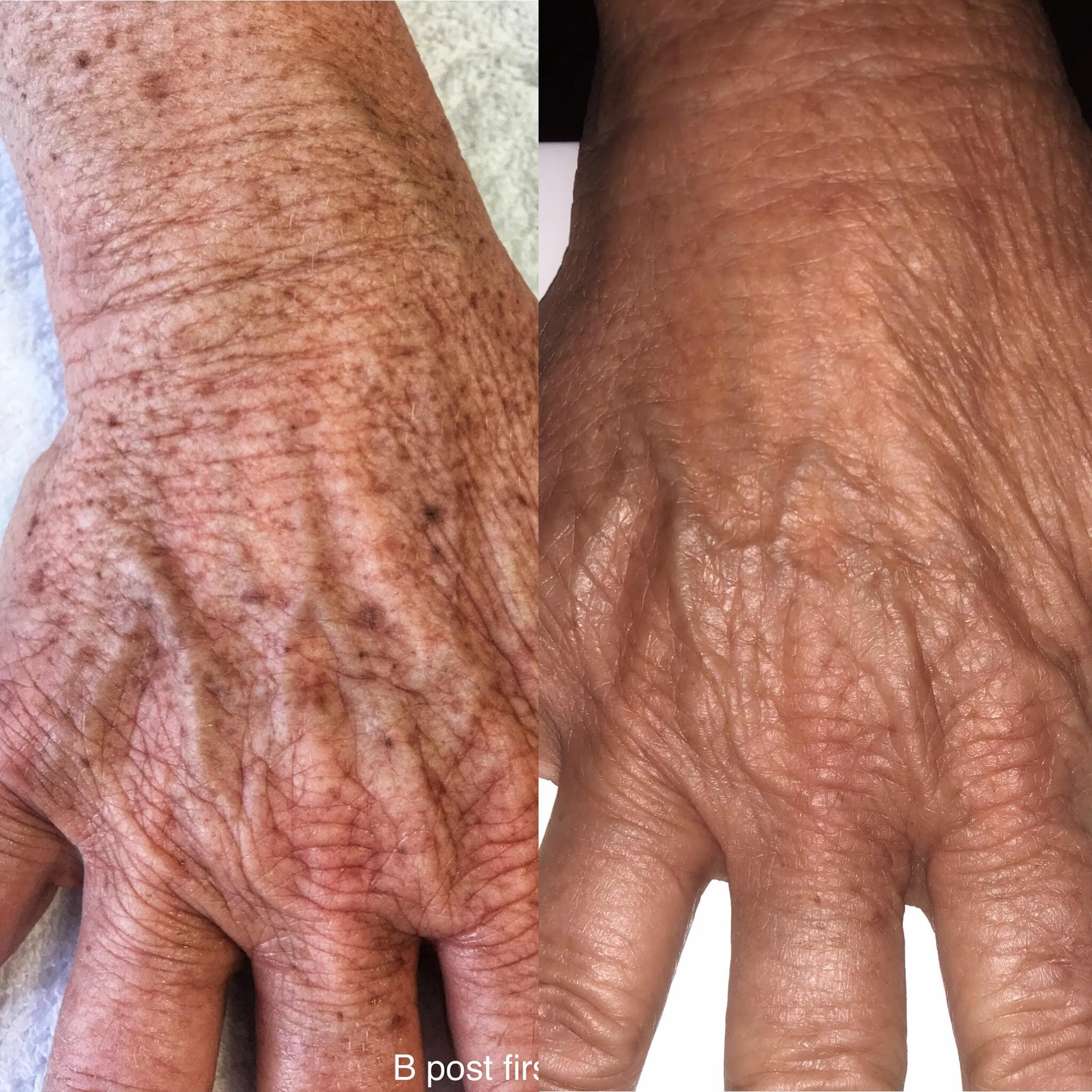 Leading Skin Technology | IPL & Laser Machines | Full Training | Eclipse Skin Technology